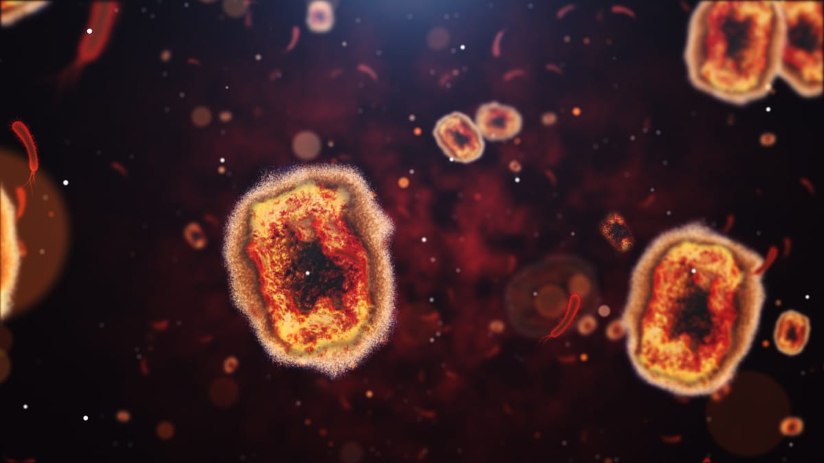 Monkeypox: What you need to know | Ohio State Health & Discovery