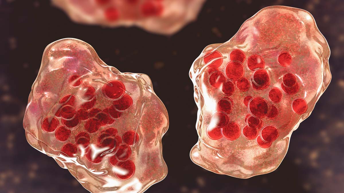 What you need to know about measles | Ohio State Health & Discovery